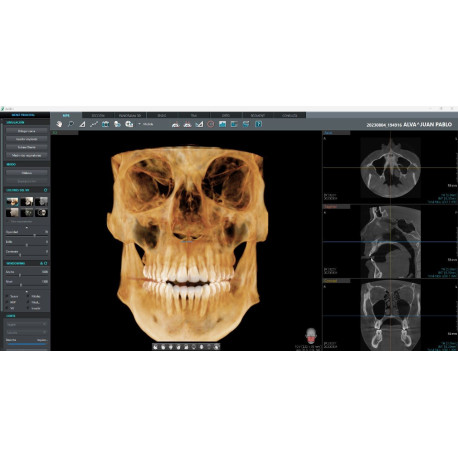 Rayos X Dental 3D Cone Beam Panorámico y Lateral Digital Vatech Green X ...