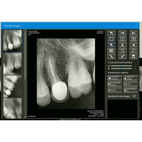 Radiovisiógrafo i-Sensor Woodpecker