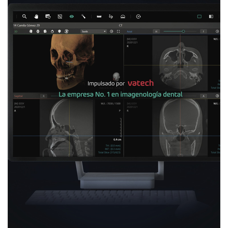 Software para Centro Radiológico Clever RC Vatech
