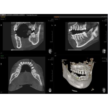 Rayos X Dental 3D Cone Beam Panorámico y Lateral Digital Vatech Smart ...