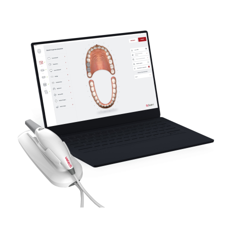 Escaner intraoral Ez Scan Vatech